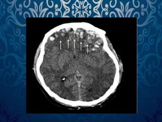 Neurological complications in omfs trauma by Dr. Amit Suryawanshi .Oral ...