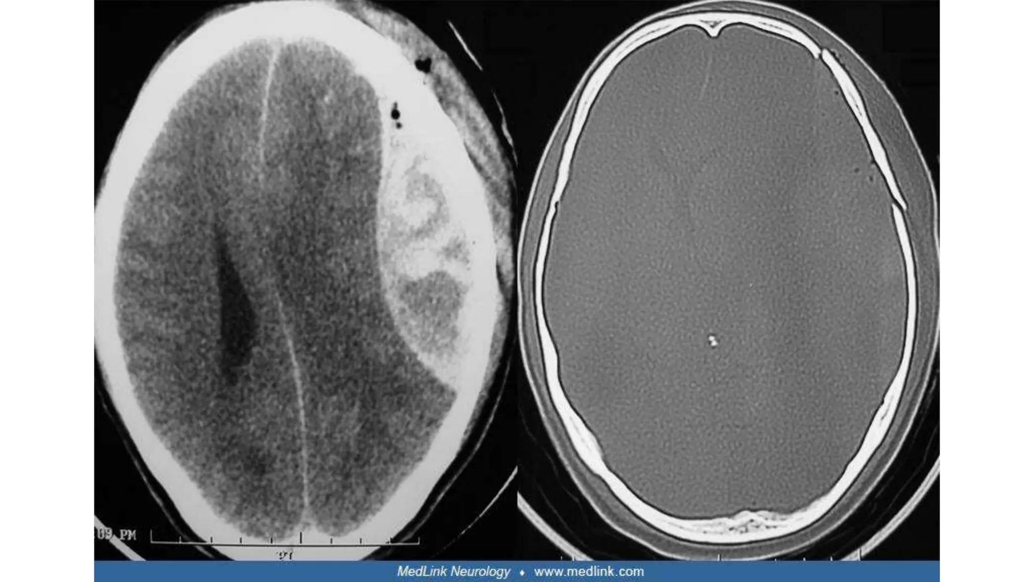 Neurological data .pptx