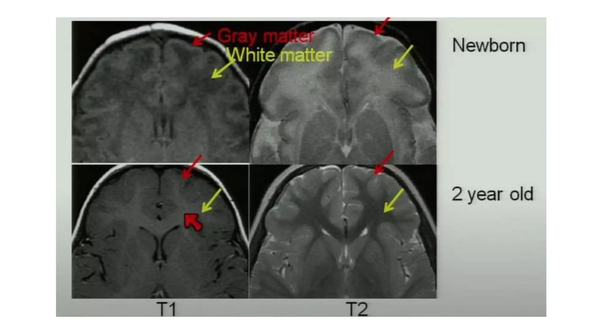 Neurological data .pptx