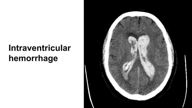 Neurological data .pptx