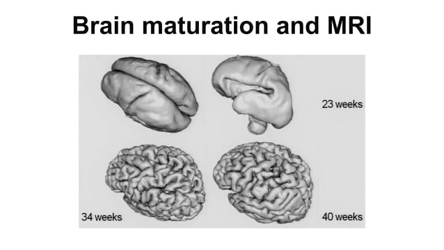 Neurological data .pptx
