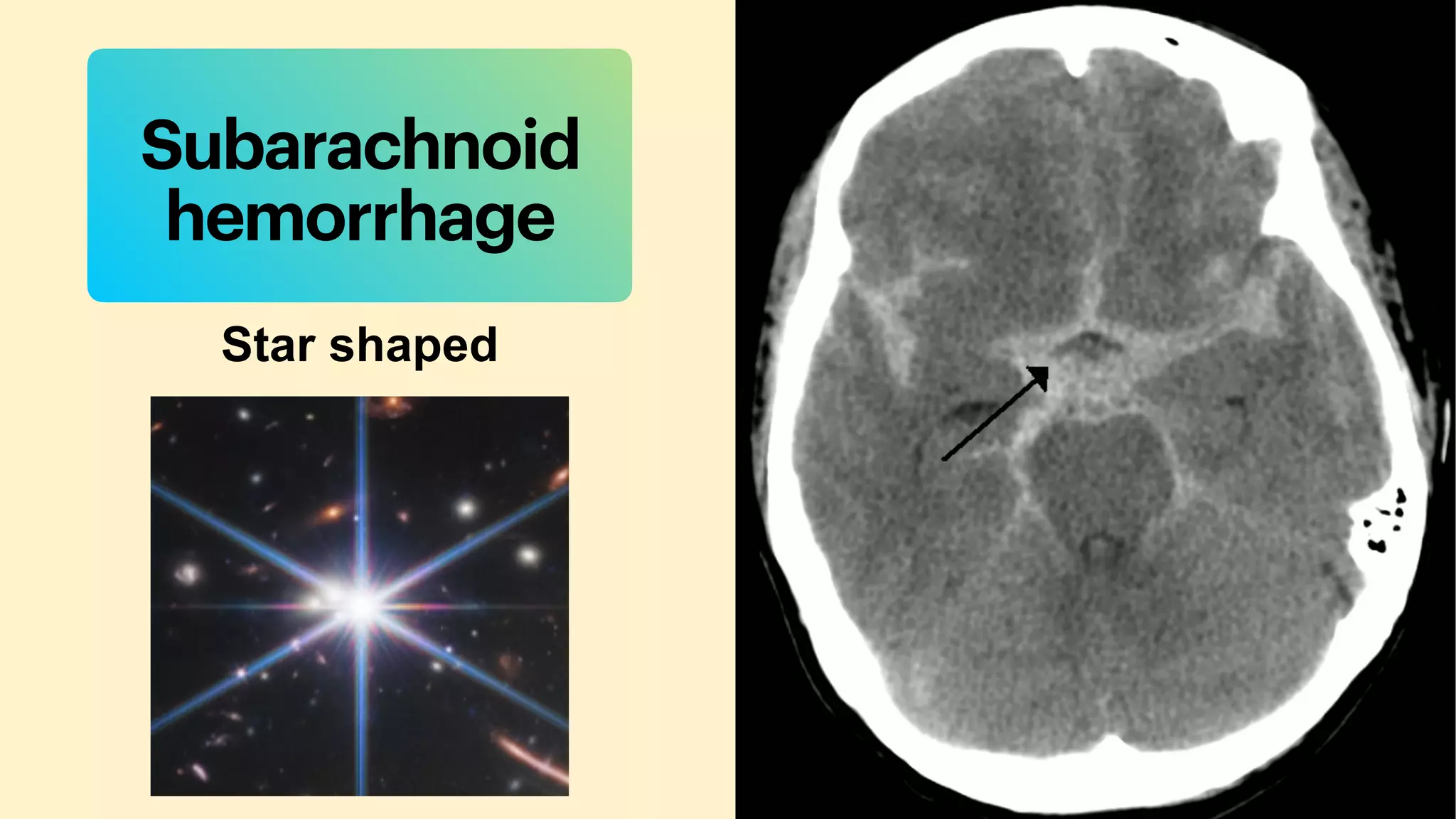 Neurological data Interpretation.pdf