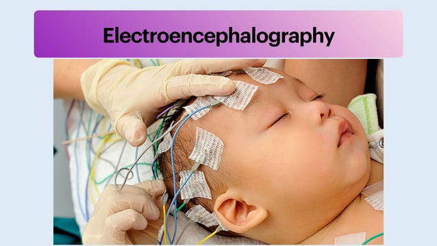 Neurological data Interpretation.pdf