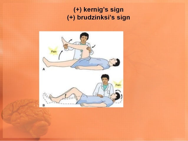Neurological disorders
