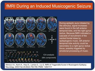 Neurological disorders of musicians and music | PPTX