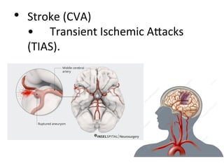Neurological disorder(stroke). presentation | PPT