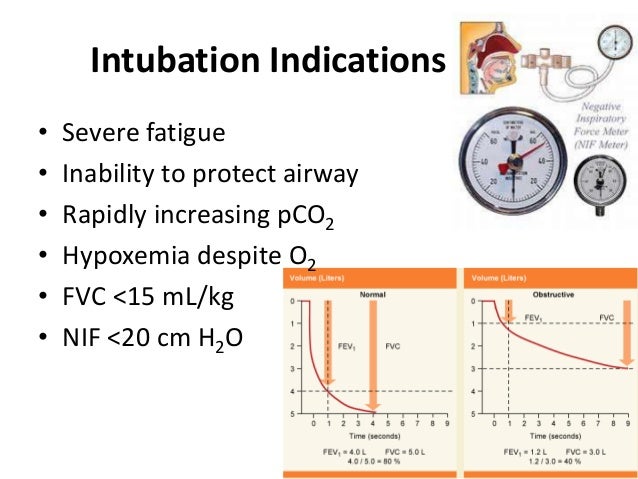 Neurological emergencies