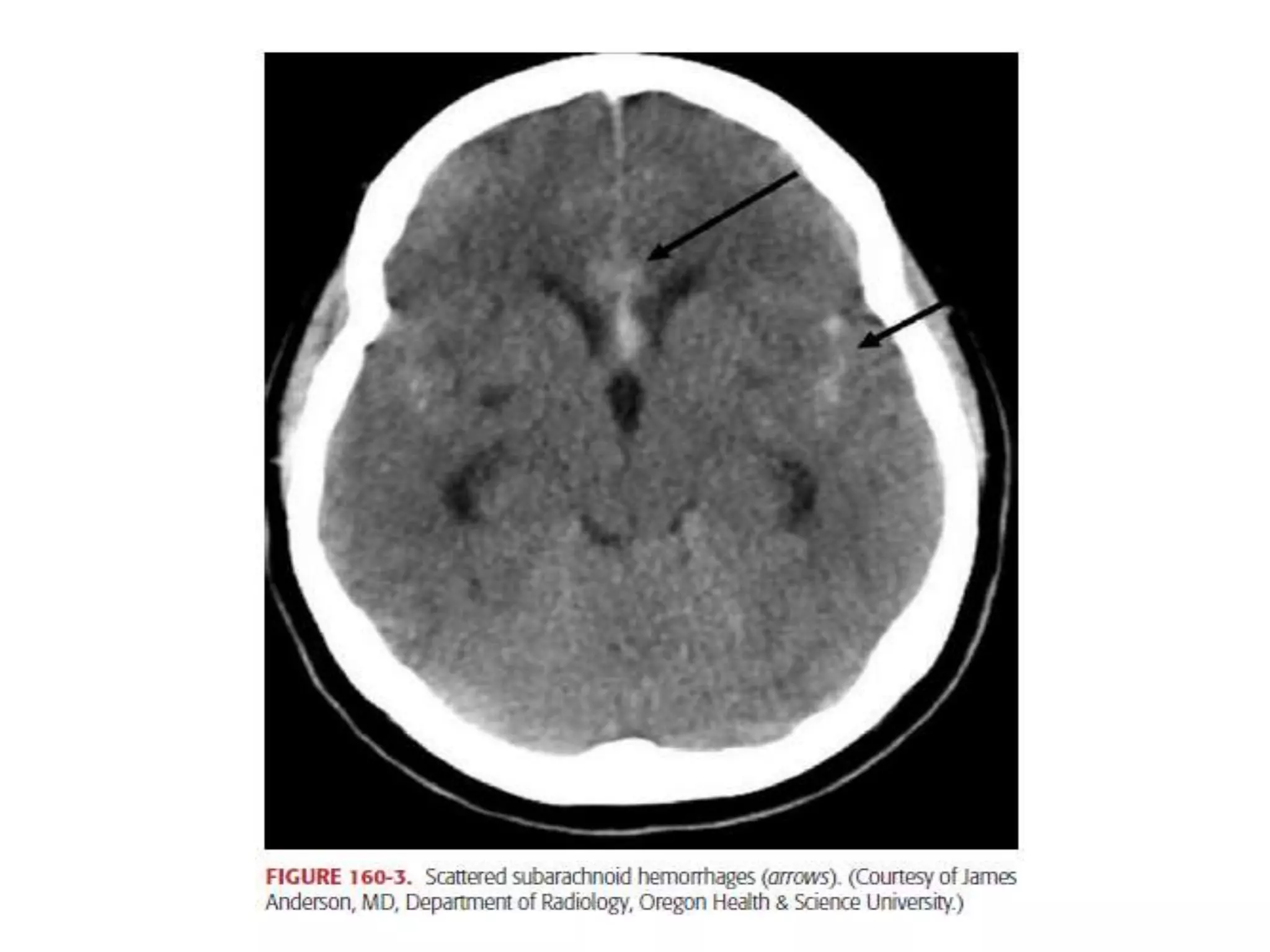 Neurological emergency(Emergency Medicine) | PPTX