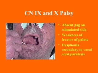 Common Sense Aspects of the Neurological Exam | PPT | Death, Injury, or ...