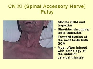 Common Sense Aspects of the Neurological Exam | PPT