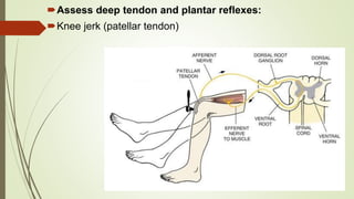 Neurological examination | PPTX