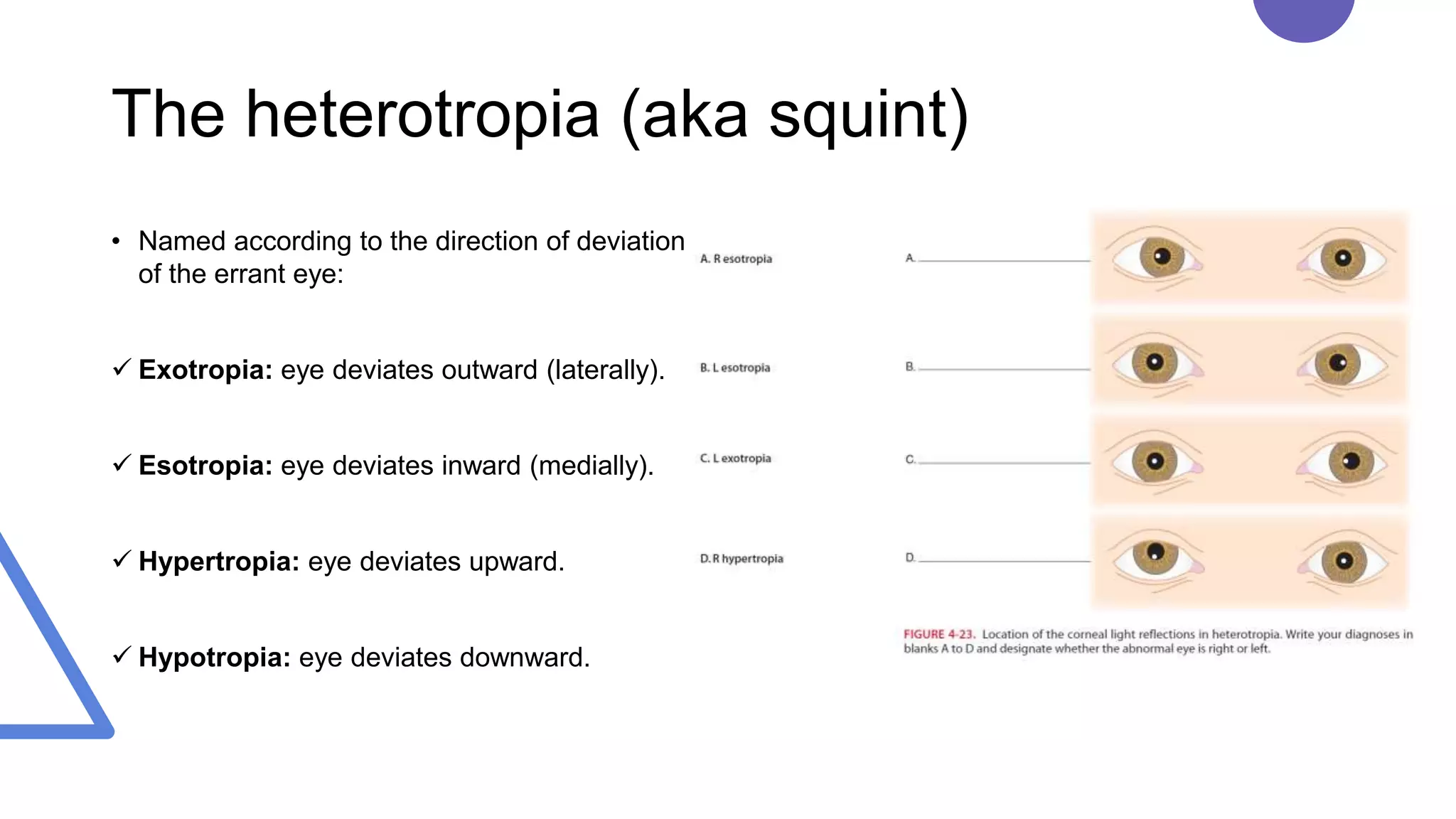 Neurological examination lec 1 vision and ocular system | PPTX