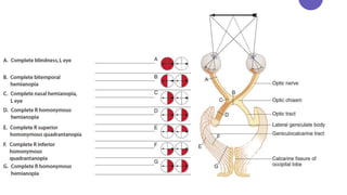 Neurological examination lec 1 vision and ocular system | PPTX