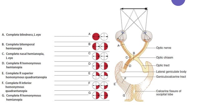 Neurological examination lec 1 vision and ocular system | PPT