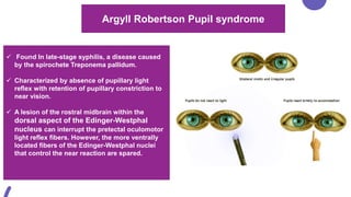 Neurological examination lec 1 vision and ocular system | PPTX