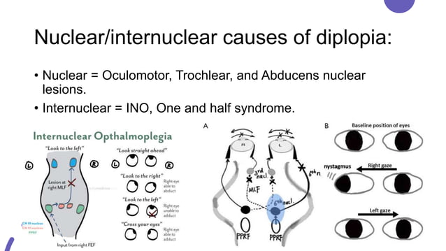 Neurological examination lec 1 vision and ocular system | PPT