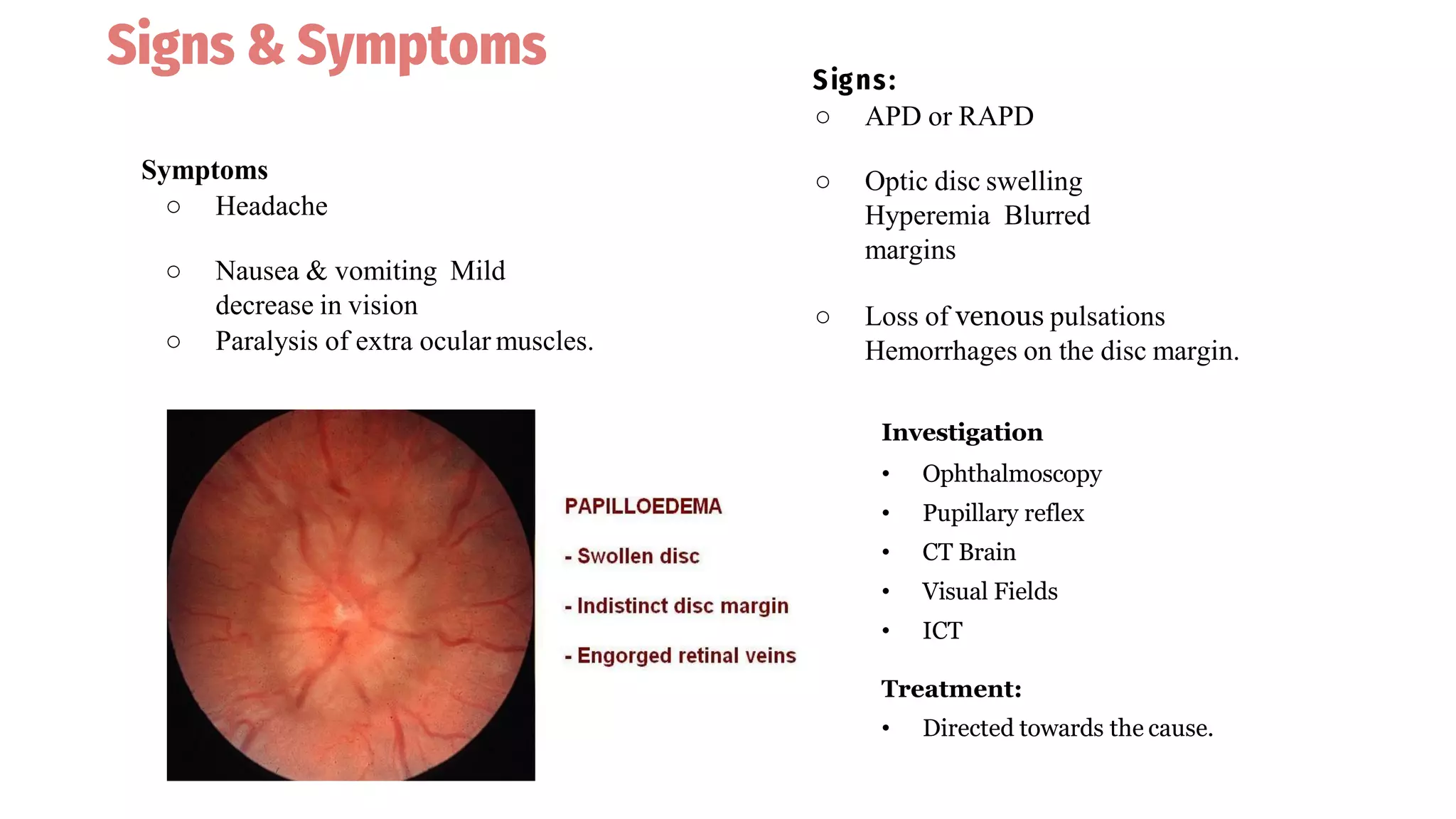 Neurological eye disorder | PDF