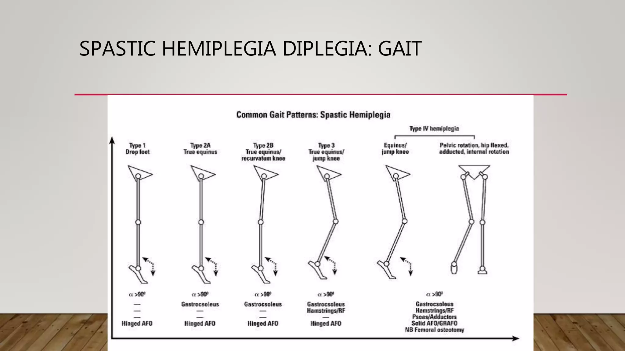Neurological Gait Rehabilitation | PPTX