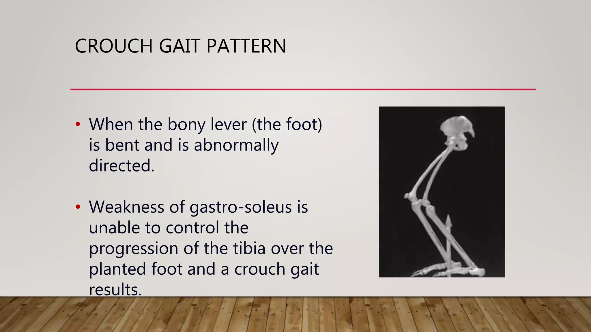 Neurological Gait Rehabilitation | PPTX