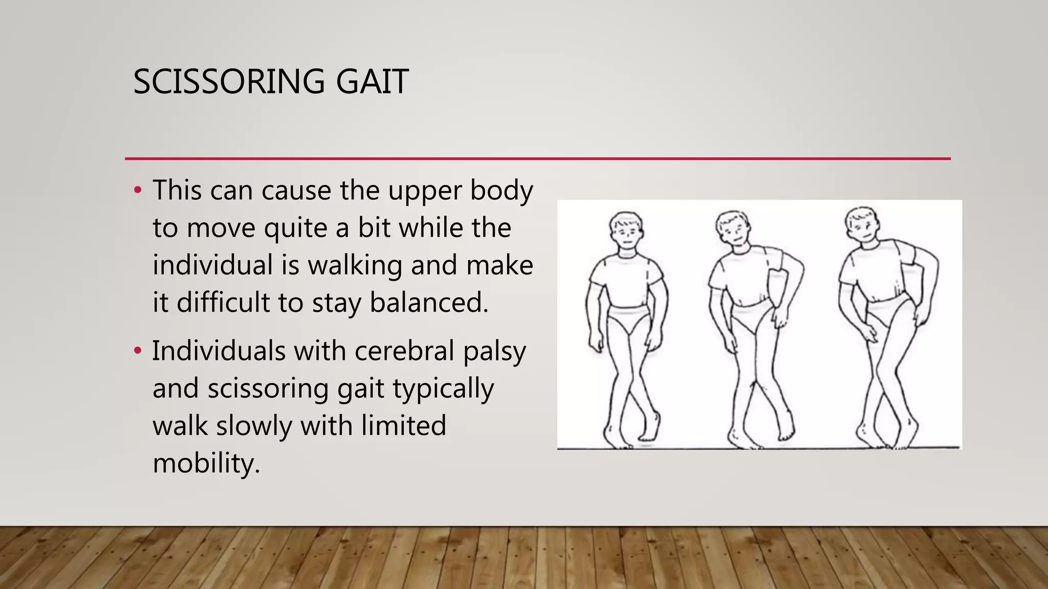 Neurological Gait Rehabilitation | PPTX