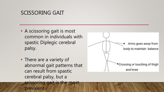 Neurological Gait Rehabilitation | PPTX