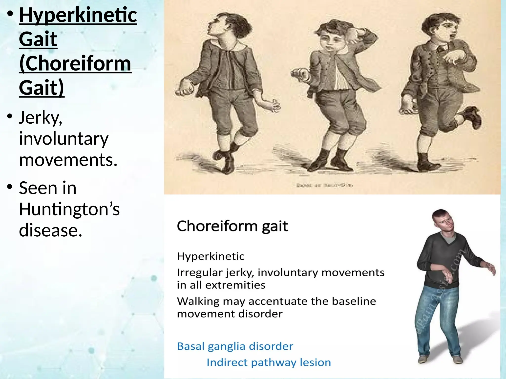 Neurological Gaits Management And Assessment With Kinetics And ...