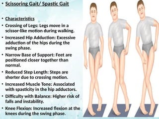 Neurological Gaits Management And Assessment With Kinetics And ...
