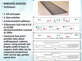Neurological Gaits Management And Assessment With Kinetics And ...