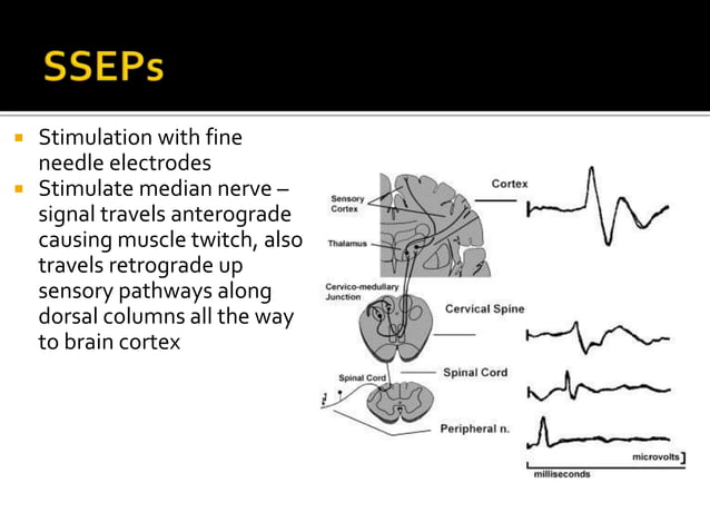 Neurological monitoring(1) | PPTX | Brain and Nervous System Disorders ...