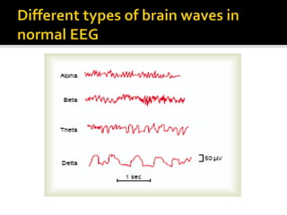 Neurological monitoring(1) | PPTX