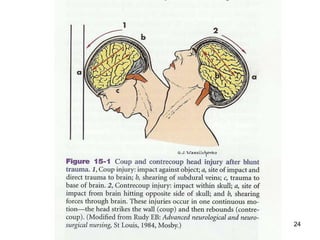 Neurological Pathophysiology.ppt