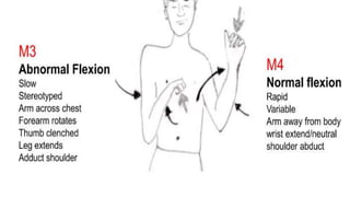 NEUROLOGICAL SCALES FOR ASSESSMENT OF CONSCIOUSNESS.pptx