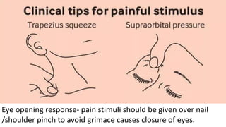 NEUROLOGICAL SCALES FOR ASSESSMENT OF CONSCIOUSNESS.pptx