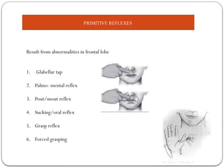NEUROLOGICAL SOFT SIGNS IN PSYCHIATRY !! | PPTX