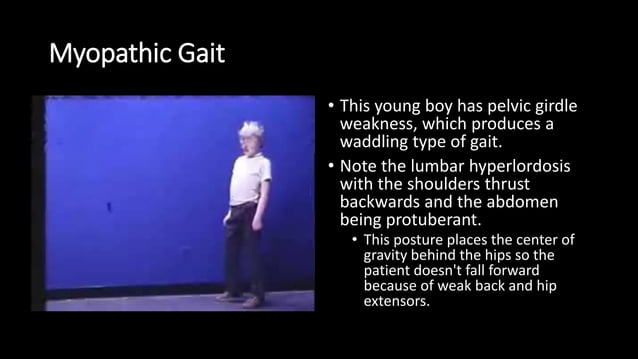 Neurological sources of gait dysfunction | PPTX
