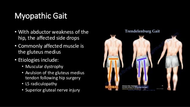 Neurological sources of gait dysfunction