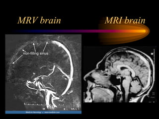 Neurologic Emergencies 9-4-09 Jacobi medicine residents.ppt