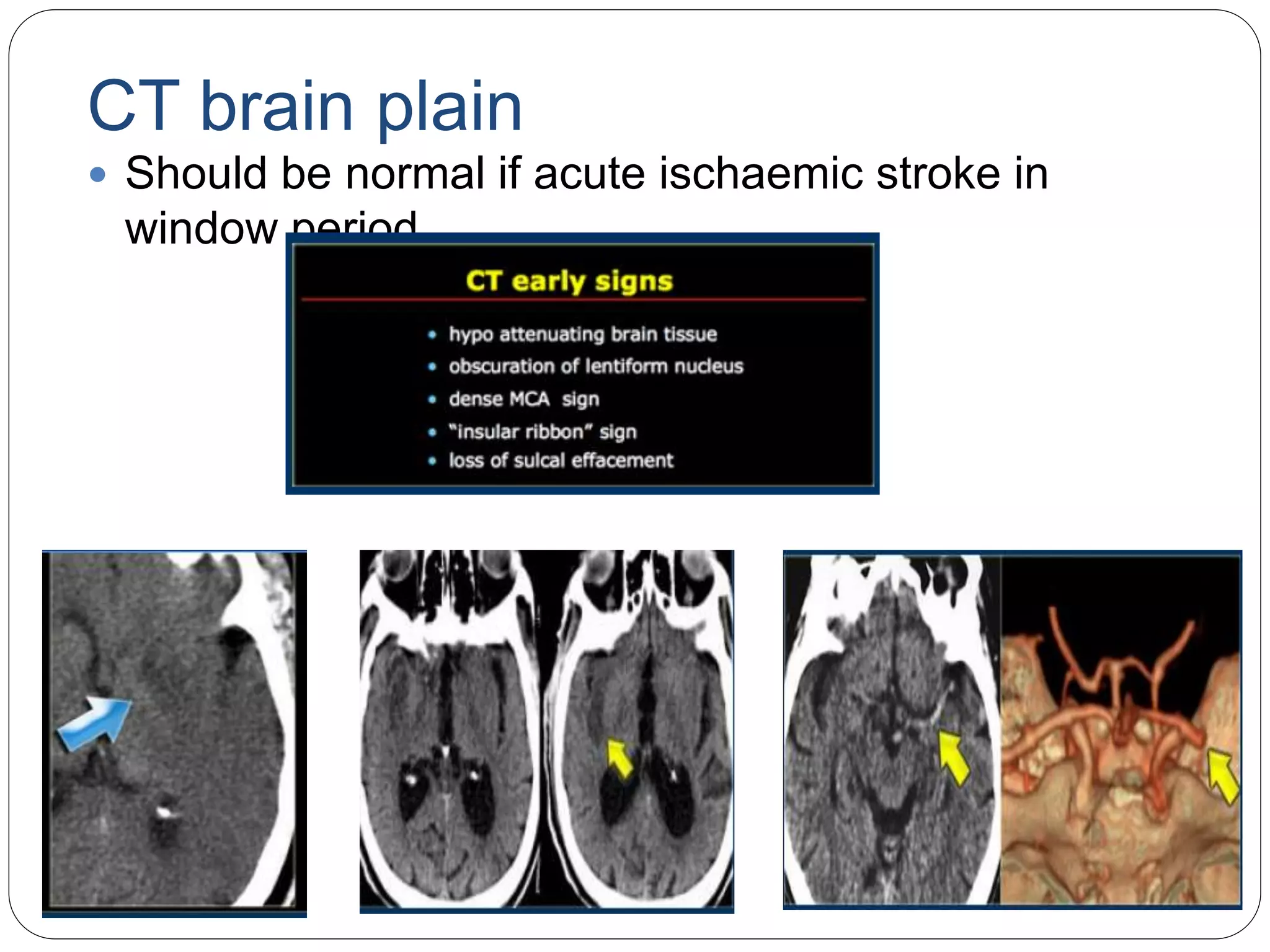 Neurology Histroy taking | PPTX