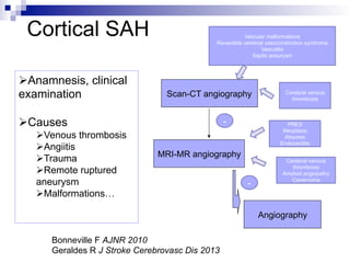 Neurology advanced hsa jy gauvrit | PDF