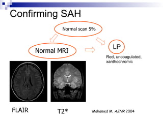 Neurology advanced hsa jy gauvrit | PPT