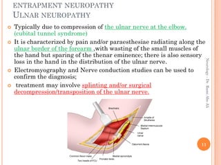 Neurology 13th peripheral neuropathy | PDF