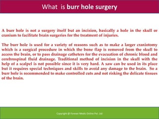 Neurology (burr hole surgery ) | PPTX