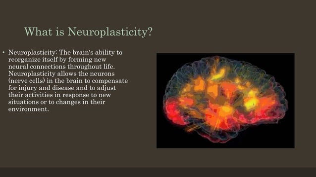 Neurology & neuroplasticity | PPT