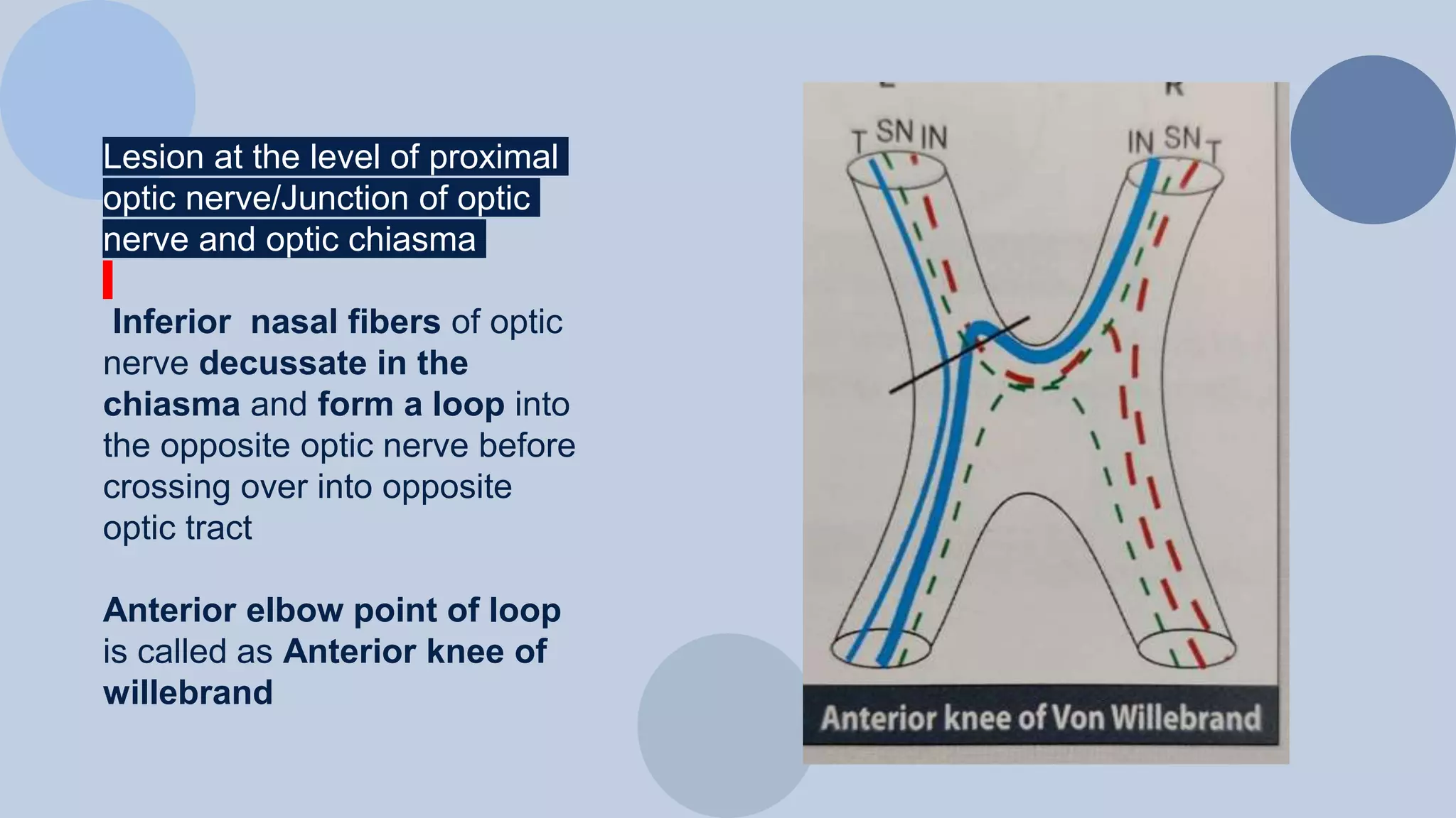 Neurology of Vision - Dr Aswini Kandasamy (2).pptx