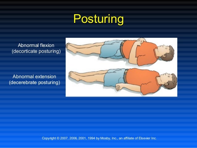 Neurology powerpoint snagit