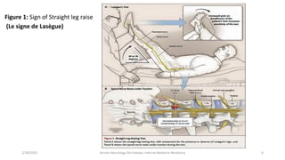 Neurology presentation | PPT