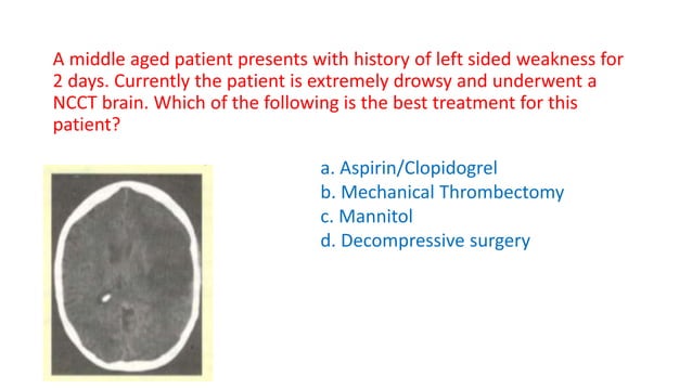 NEUROLOGY QUICK REVISION for examination | PPT