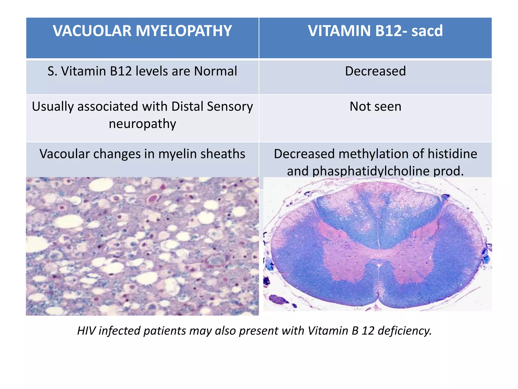 Neurological manifestations of HIV | PPTX
