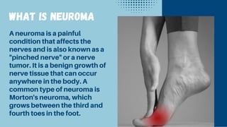 Neuroma Symptoms, Causes & Treatments | PPT