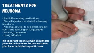 Neuroma Symptoms, Causes & Treatments | PDF